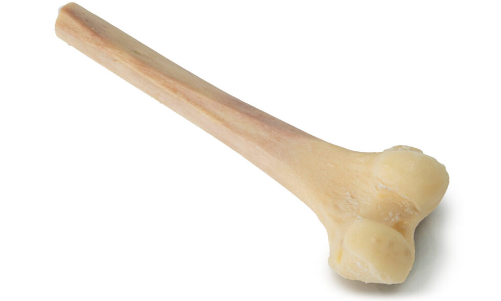 Femoral Grafts - Maxxeus